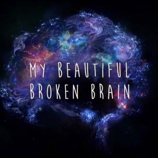 My Beautiful Broken Brain – Start Seeing CVI
